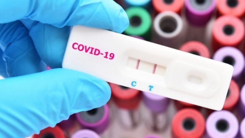 Rapid Test Produk Dalam Negeri - PT Interskala Medika Indonesia